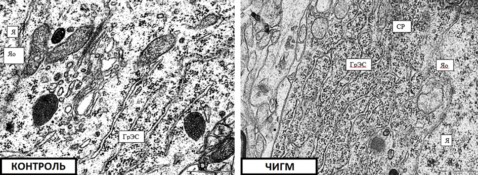 Changes in the Organelles of Neurons in The Parietal Cortex and ...