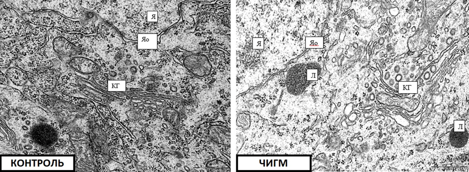 Changes in the Organelles of Neurons in The Parietal Cortex and ...