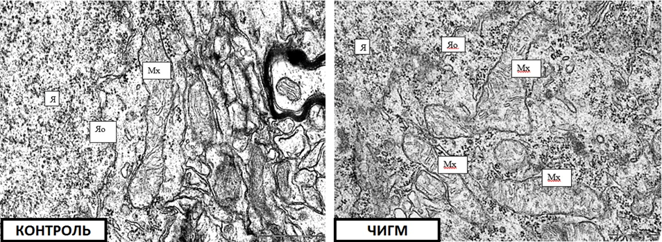 Changes in the Organelles of Neurons in The Parietal Cortex and ...